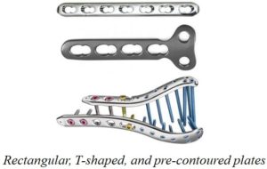 Engineering at Alberta Courses » Bending as a failure mode