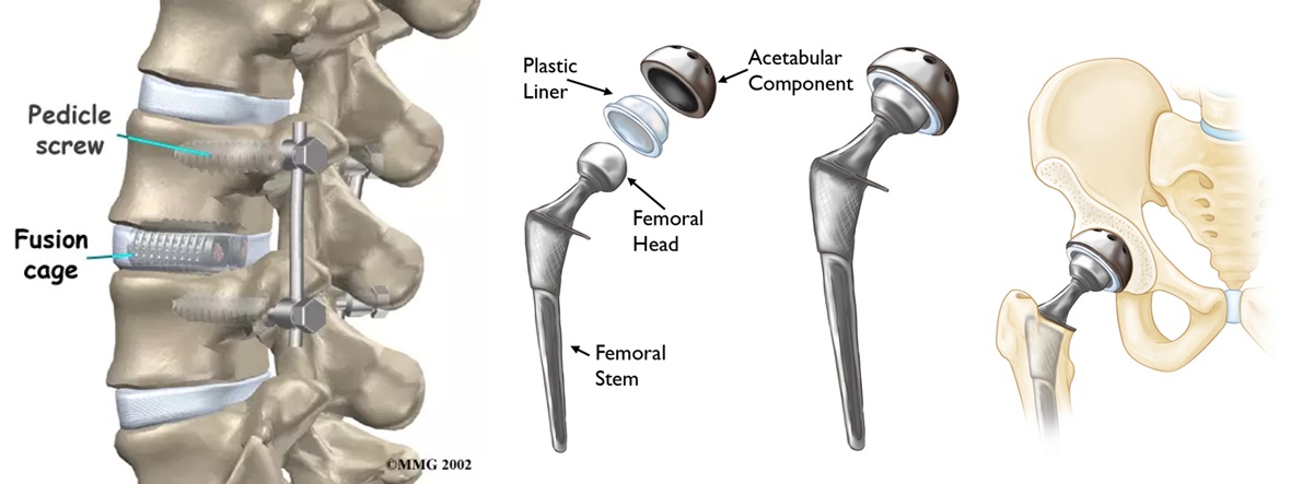 Engineering at Alberta Courses » Plastics